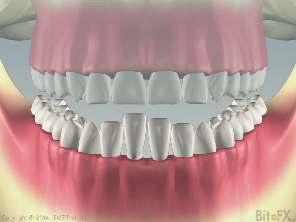 September 2014 BiteFX Updates