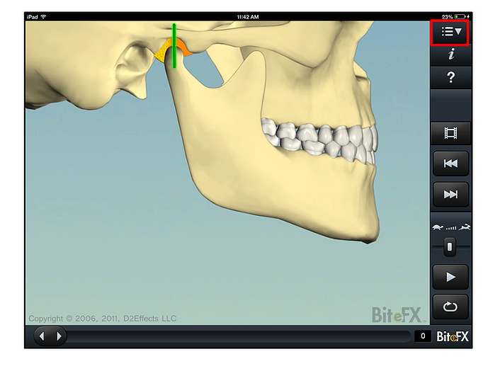 Installing BiteFX for iPad