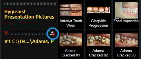 How to Use the Hide/Unhide Image Controls in BiteFX for Windows