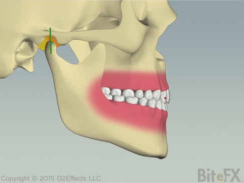 April 2015 BiteFX Updates