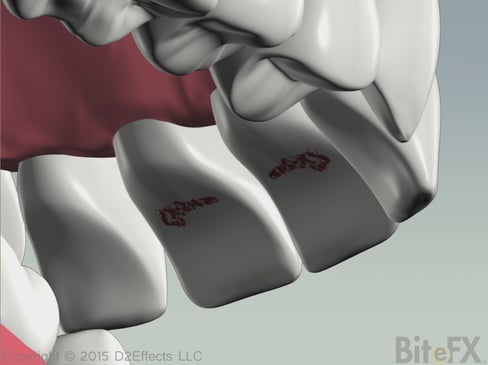 April 2015 BiteFX Updates