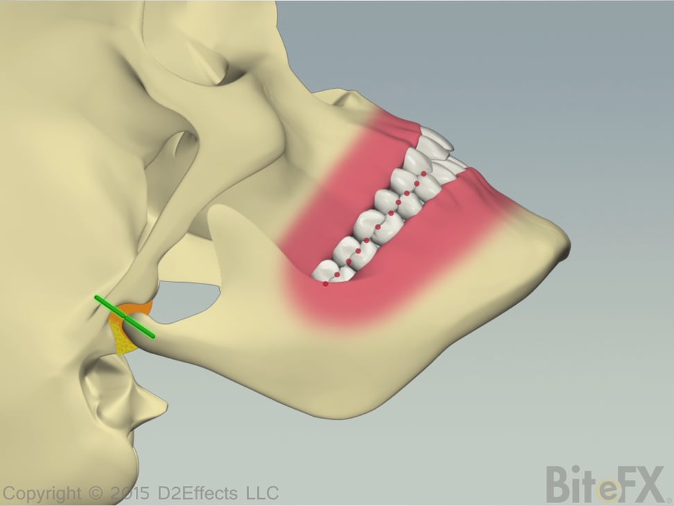 April 2015 BiteFX Updates
