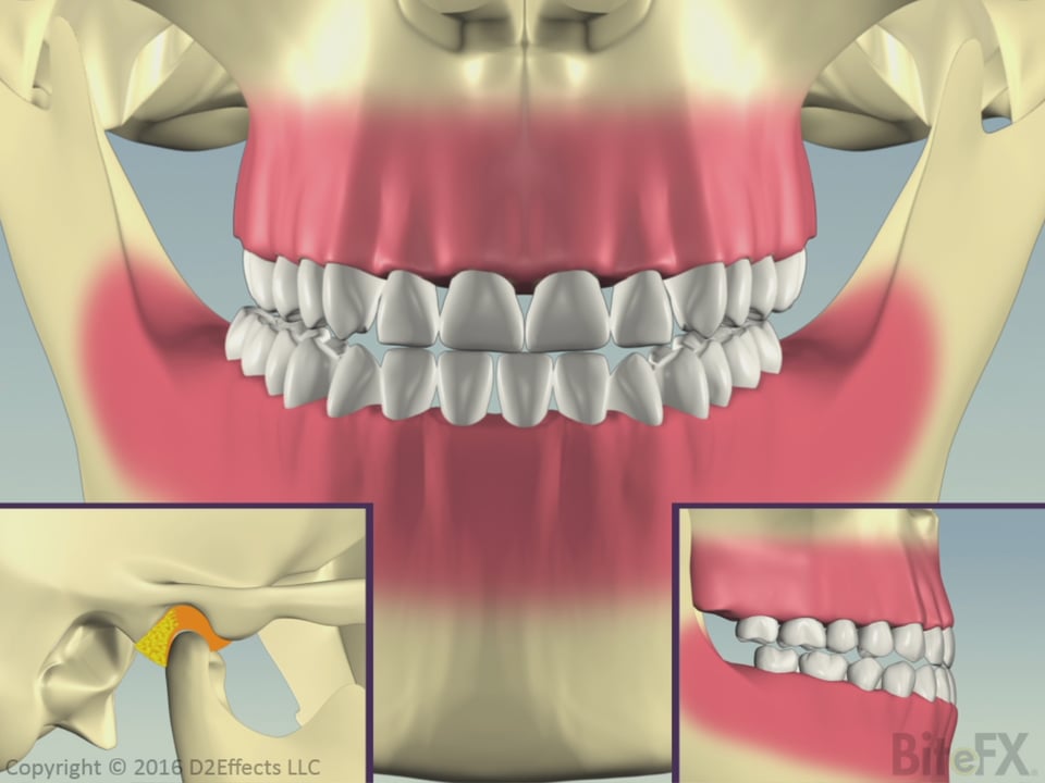 July 2016 BiteFX Update