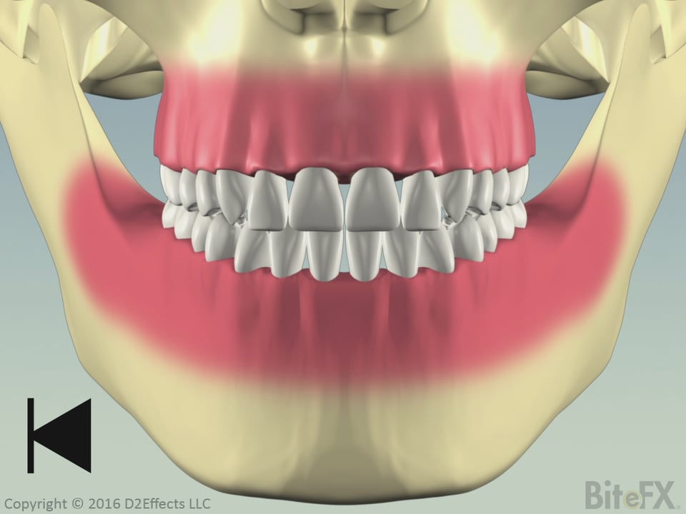 July 2016 BiteFX Update